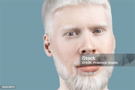 백색주의 개념 흰 머리 창백한 피부와 파란 눈 청록색 배경을 가진 젊은 수염을 가진 알비노 남자의 초상화 그루터기 얼굴부위 털에