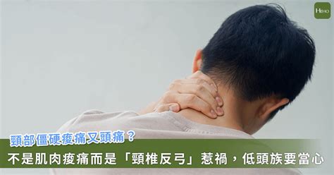 脖子痠痛、手麻「頸椎反弓」惹禍？症狀、原因、治療一次看 蕃新聞