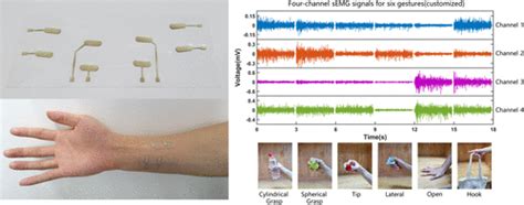 Surface Electromyography