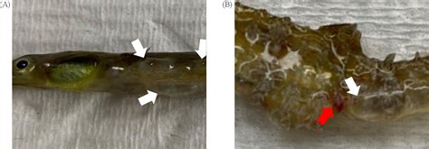 Figure 2 From A Case Report Of Secondary Infection By Vibrio Splendidus
