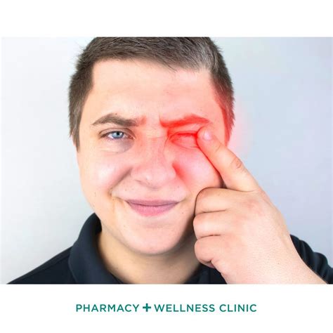 The Health Dispensary Ltd On Linkedin Nhs Conjuncivitis Eyes Eyecare