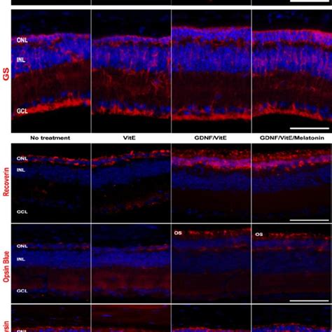 Immunohistochemical Analysis A Glial Marker Expression The