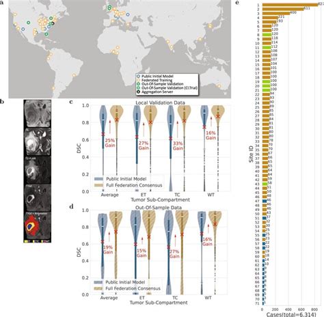 Intel And Upenn Pioneer Machine Learning That Dramatically Improves Brain Tumor Detection