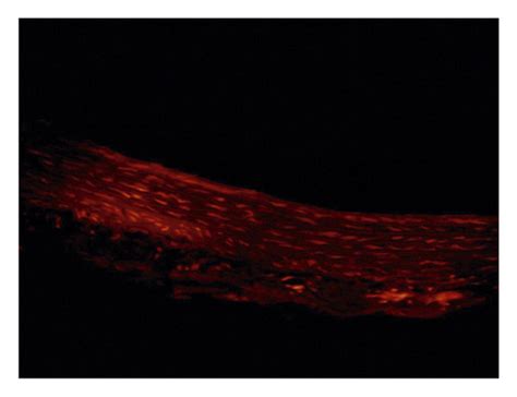 Detection Of Superoxide Anions O2− Generation In Aorta Download