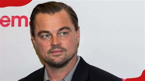 10 Famous Cleft Lip And Palate Celebrities To Inspire You