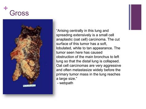 Lung Cancer Pathology And Clinical Pptx