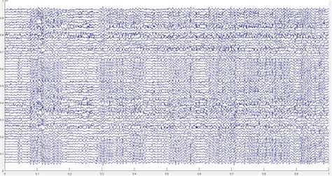 Eeg Lunatic Laboratories