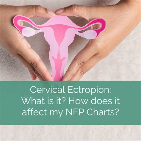 Cervical Ectropion And Nfp Charting Pearl And Thistle