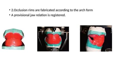 A Method Of Crossbite Setting In Class 3pptx Free Download