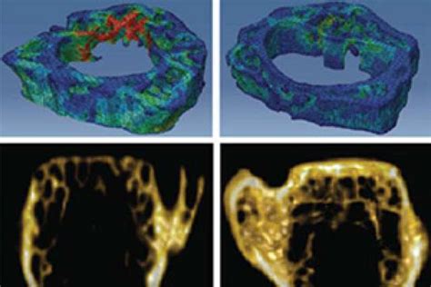 Ucla Study Reveals Bone Building Proteins Impact On Bone Stem Cells