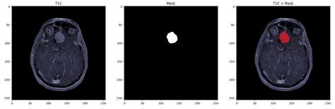 Problem In Image And Its Mask Superposition Beginner Questions Itk
