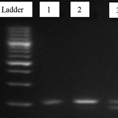 Dna Electrophoresis Of The Mthfr C677t Mutation On 3 0 Agarose Gel 1 Download Scientific