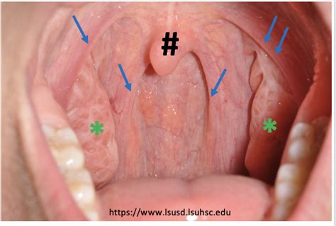 Oropharynx Diagram Quizlet