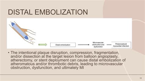 Periprocedural Myocardial Infarction In Contemporary Practise Pptx