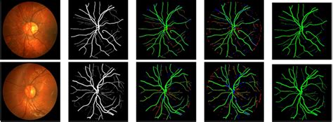 segmentation results of fes net and comparative methods on