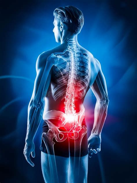 Painful Sacroiliac Joint Stock Illustration Illustration Of Human