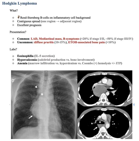 Framing Lymphomas For Clinical Reasoning A Herculean Task Given Long