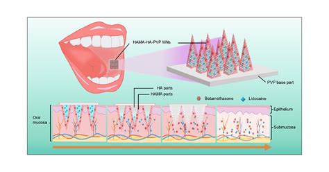 Novel Double Layer Dissolving Microneedles For Transmucosal Sequential Delivery Of Multiple