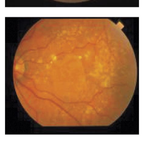 Preprocessing Effect Diagram The First Row Is The Drive Dataset The Download Scientific