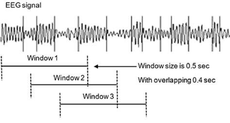 example of eeg signals partitioned into small segments using sliding
