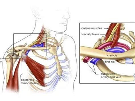 Costoclavicular Space