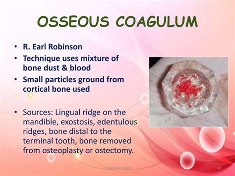 Autogenous Bone Grafting Ppt