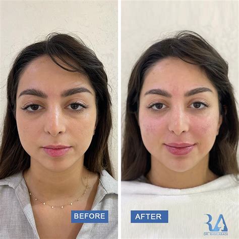 Dr Rami Abadi Dermatologist And Cosmetic Dermatology Expert Hamra