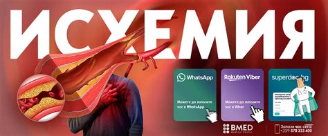 Какво е исхемична болест на сърцето ИБС Bmed Bg