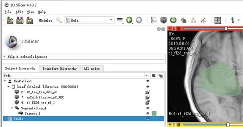 在3d Slicer中同时加载和测量多个序列 知乎
