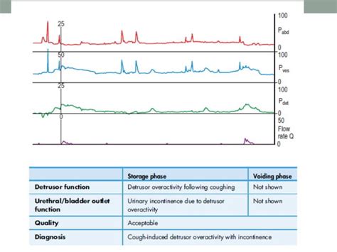Urology Neurogenic Bladder Urodynamicspptx