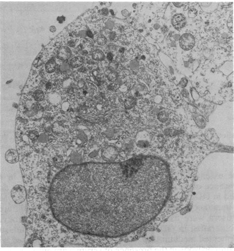Transmission Electron Micrograph Of Isolated Oligodendrocytes After 5 Download Scientific