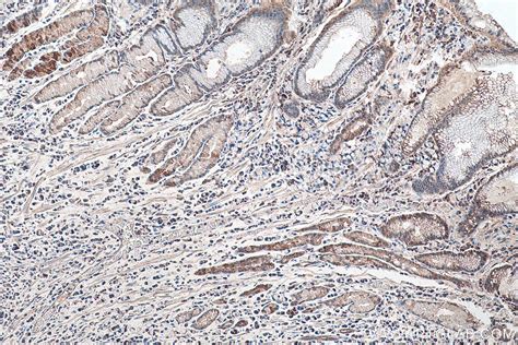 Ihceasy Gatm Ready To Use Ihc Kit Khc0560 Proteintech 武汉三鹰生物技术有限公司