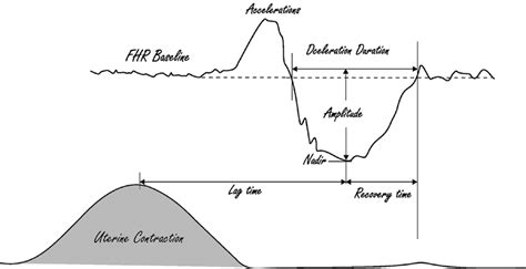 1 Location Of The Recovery Time Nadir And Deceleration Duration