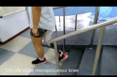 Functional Prosthetic Microprocessor Knee Joint For Handicapped Cable Operated At Rs 300000 In