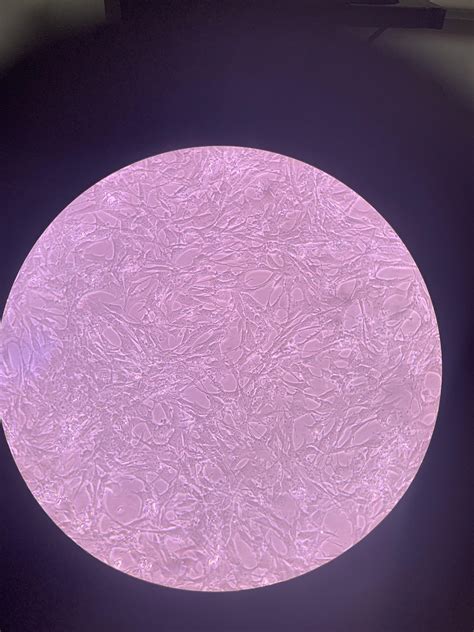Embryonic Stem Cells Differentiating 100x Phase Contrast Rmicroscopy
