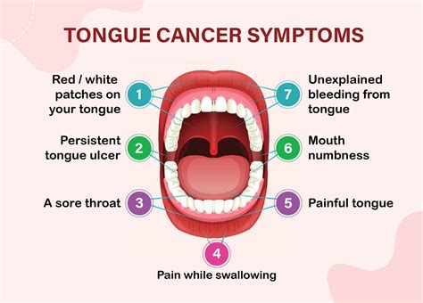 Best Oraltongue Cancer Specialist In Delhi Dr Priya Tiwari