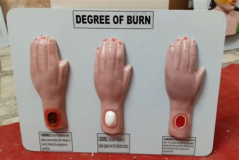 Forensic Medicine Model At ₹ 3500 Piece Forensic Models In Ambala Id 2853028708788