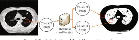 Figure 1 From Design Computer Aided Diagnosis System Based On Chest Ct Evaluation Of Pulmonary