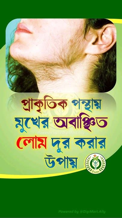 প্রাকৃতিক উপায়ে মুখের লোম দূর করার উপায় Shorts2024 Skincaretips Newshortfeed Youtube