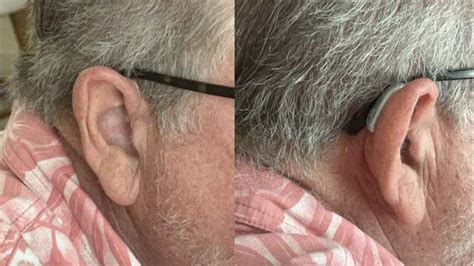 Jabra Enhance Select Reviews And Sound Samples