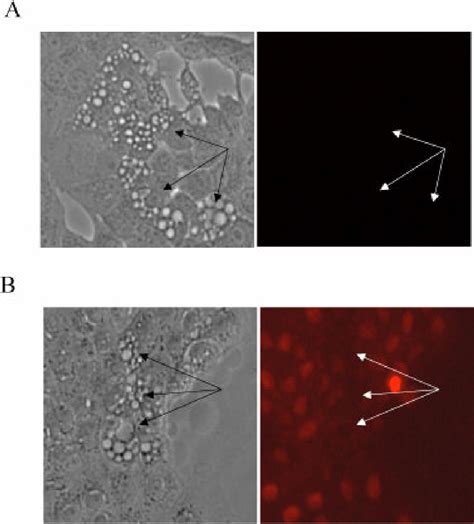 Cpbvdv Induced Cytoplasmic Vacuolization Is Not Associated With Loss Of