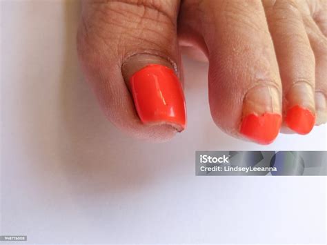심하게 못생긴 여자의 발 긴 연어 색된 발톱을 신랑 페디큐어가 필요 합니다 연체 페디큐어입니다 흰색 배경에 고립 건강관리와 의술에 대한 스톡 사진 및 기타 이미지 Istock