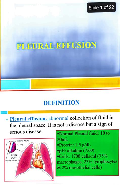 Pleural Effusion And Its Management Slide 1 Of Pleural Effusion Definition Pleural Effusion