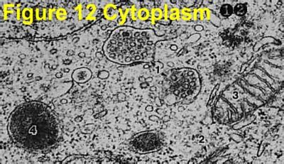 Electron Micrographs