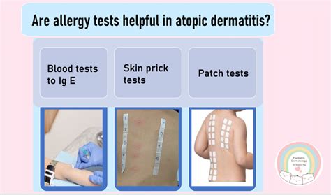 Allergy Skin Tests Ark Dermatology