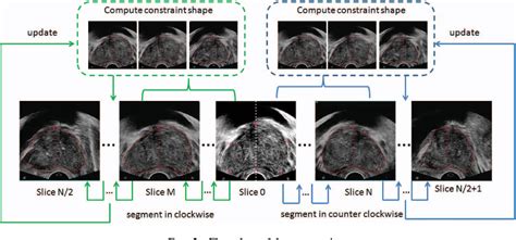 Figure 1 From Three Dimensional Prostate Segmentation Using Level Set