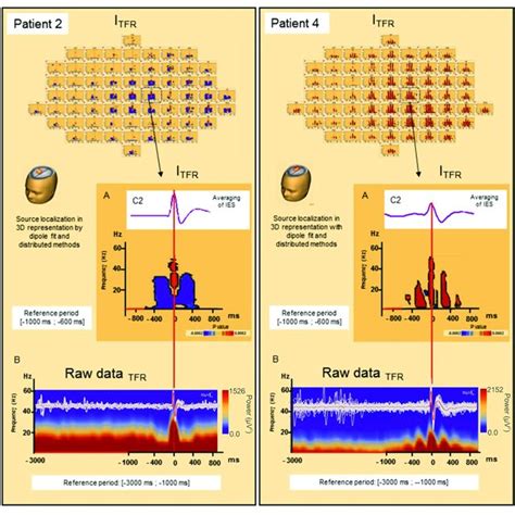 Source Localization Using The Dipole Fitting Method And The Download Scientific Diagram