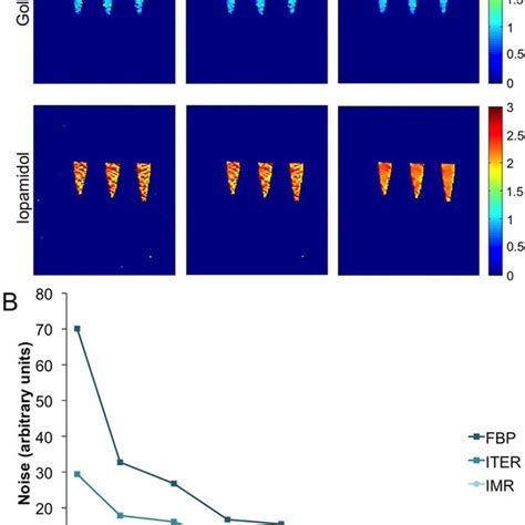 Effect Of Reconstruction Algorithm In Dual Energy Ct A Dual Energy Download Scientific