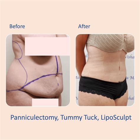 Mehta Bariatric Center