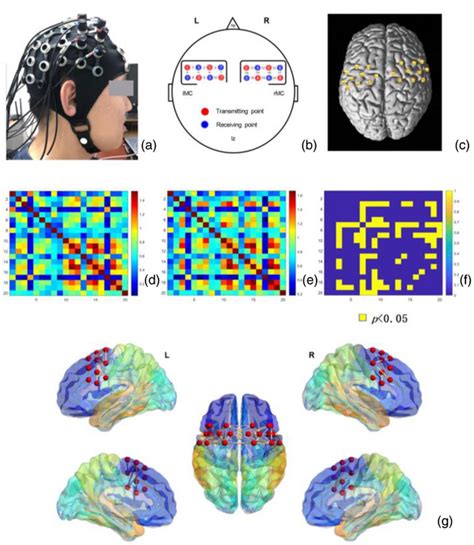 Resting State Functional Connectivity Rsfc Data Presentation And